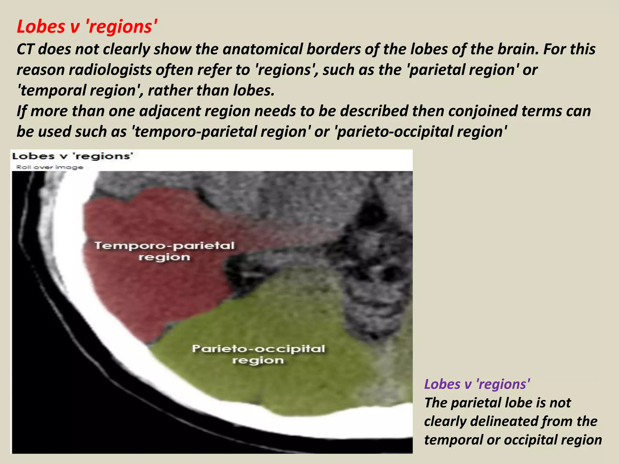 Presentation1.pptx, radiological anatomy of the brain. | PPTX
