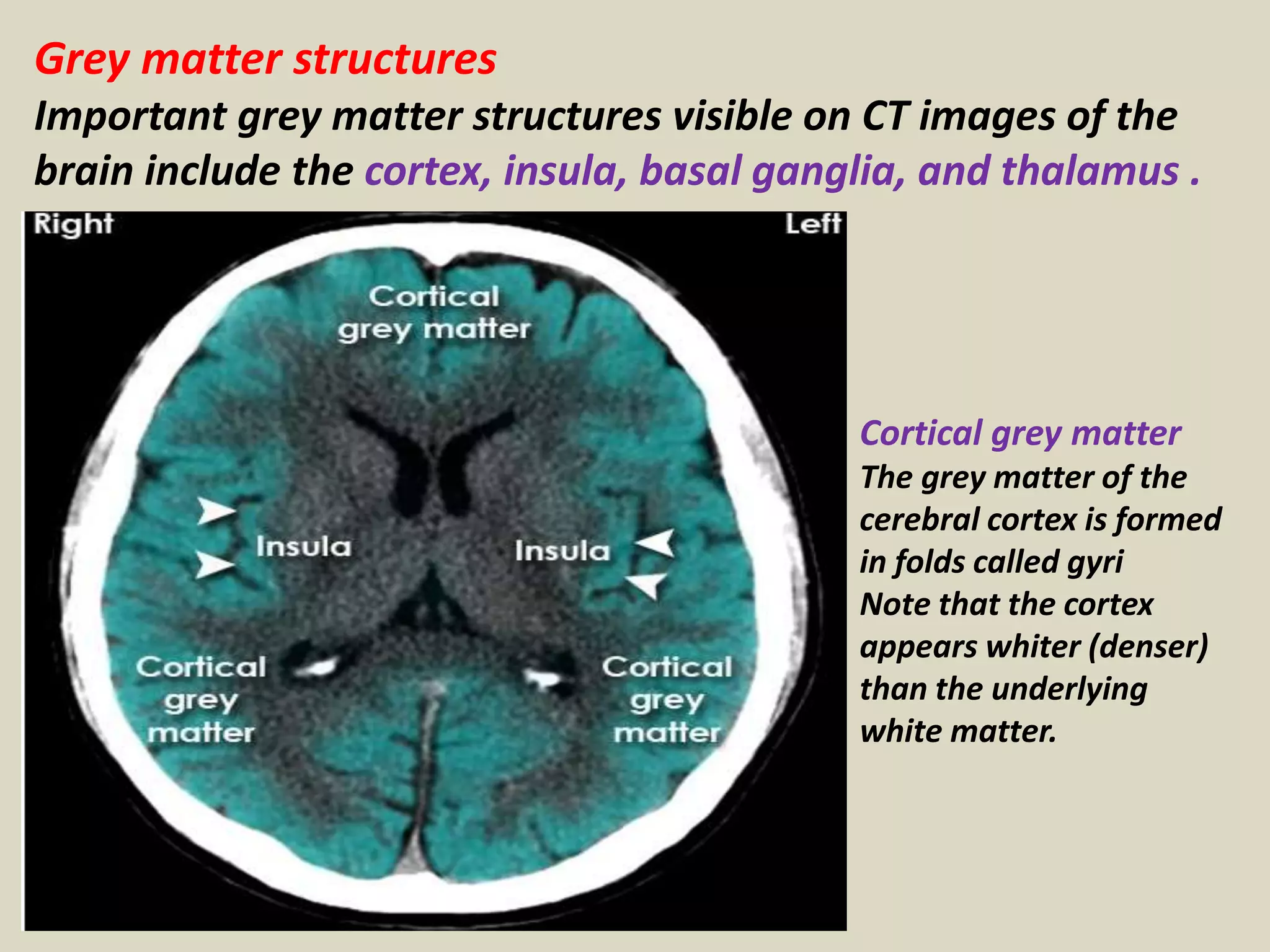 Presentation1.pptx, radiological anatomy of the brain. | PPTX