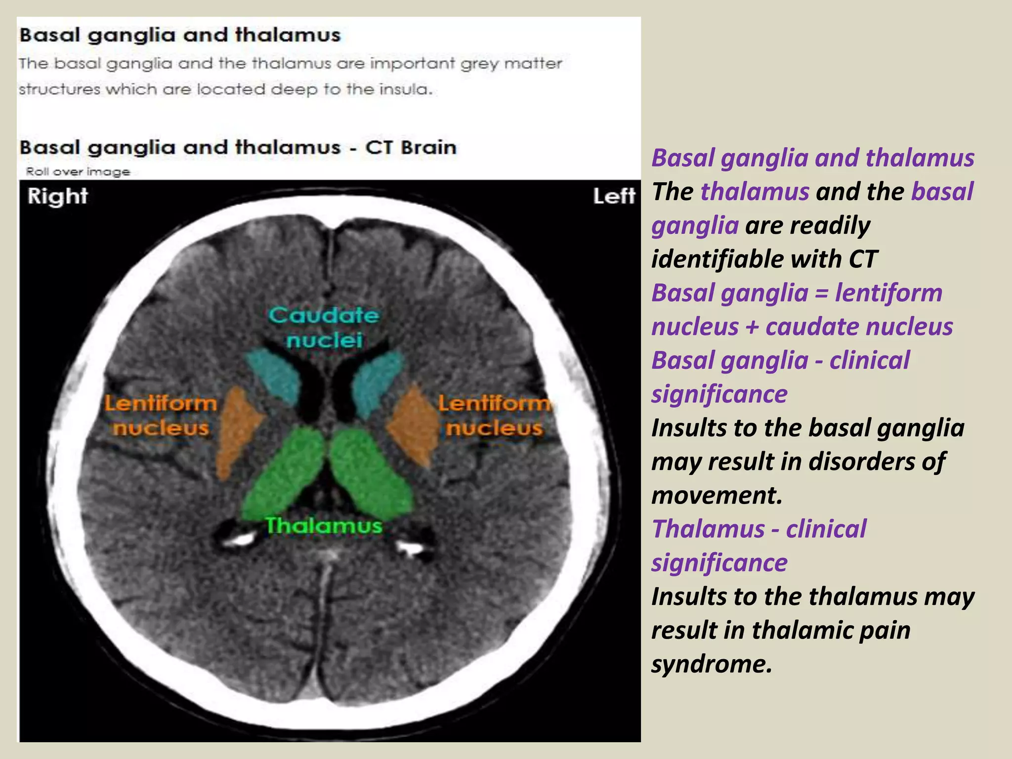 Presentation1.pptx, radiological anatomy of the brain. | PPTX | Brain and Nervous System ...