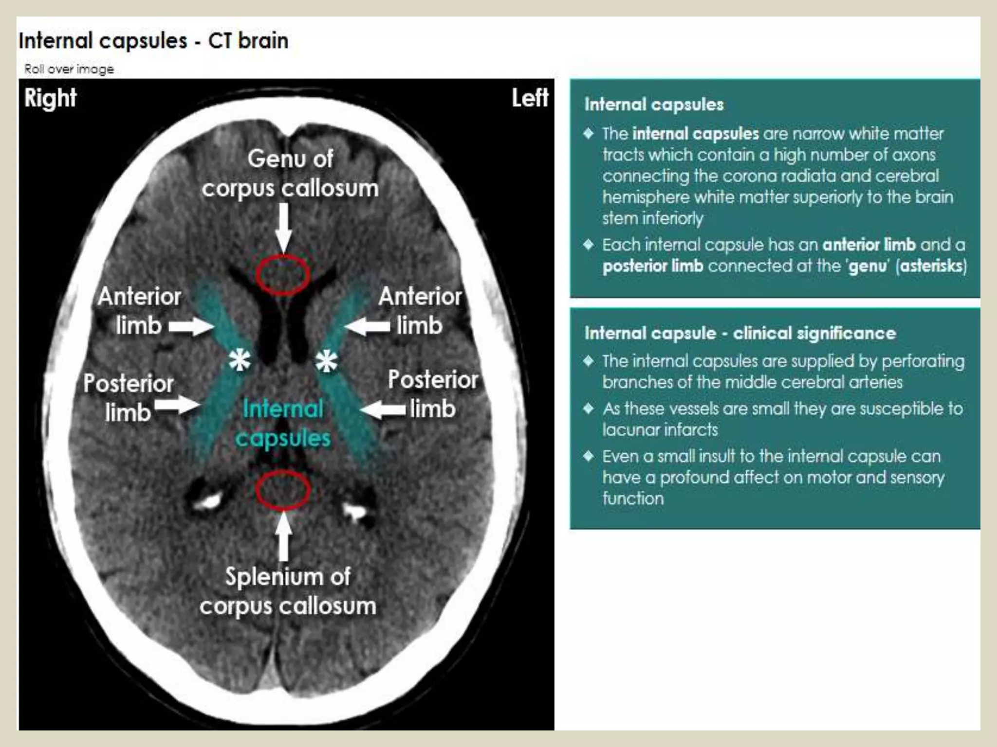 Presentation1.pptx, radiological anatomy of the brain. | PPTX | Brain and Nervous System ...