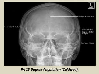 Presentation1.pptx, radiological anatomy of the brain. | PPTX