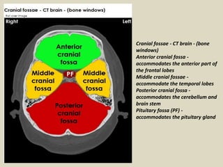 Presentation1.pptx, radiological anatomy of the brain. | PPTX