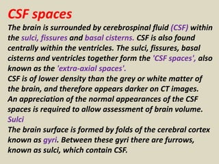 Presentation1.pptx, radiological anatomy of the brain. | PPTX