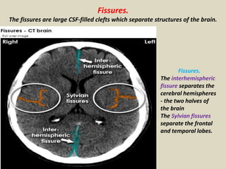 Presentation1.pptx, radiological anatomy of the brain. | PPTX