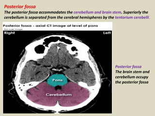 Presentation1.pptx, radiological anatomy of the brain. | PPTX