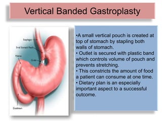 bariatric nutrition: a way to manage obesity | PPTX