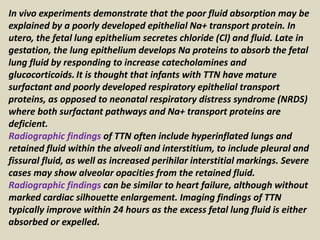 Presentation1.pptx, radiological imaging of neonatal lung disease. | PPTX