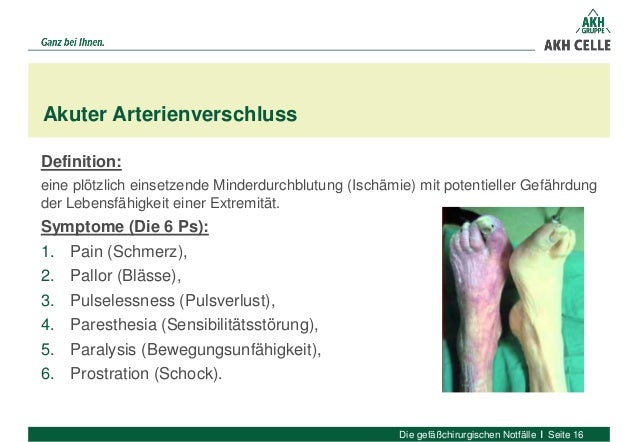 Die gefäßchirurgischen Notfälle