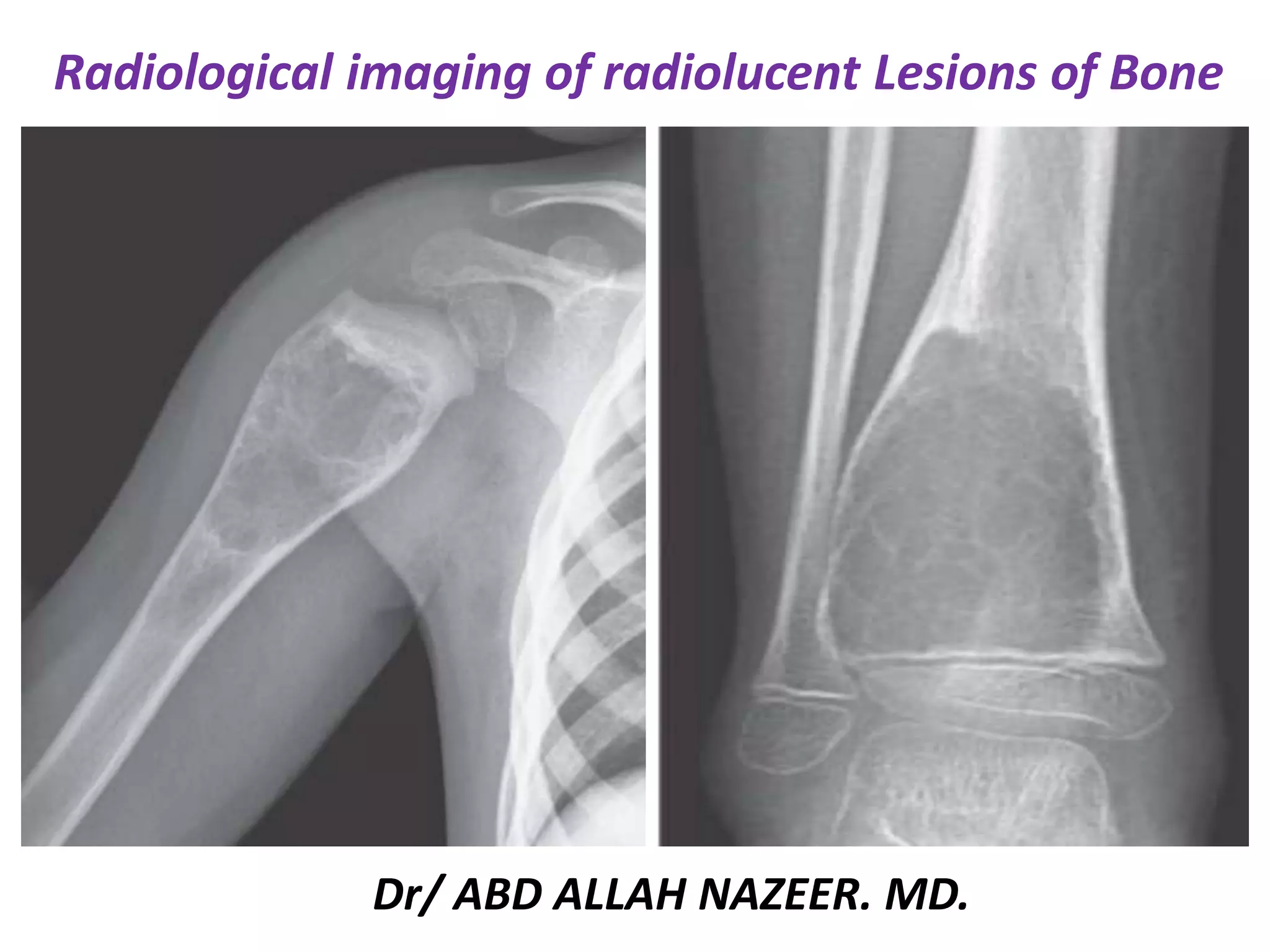 Presentation1.pptx, radiological imaging of rediolucent lesions of ...