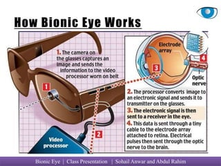 Bionic Eye | PPT