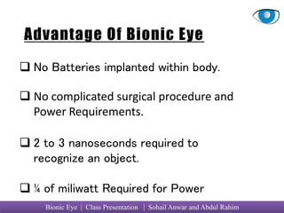 Bionic Eye | PPT
