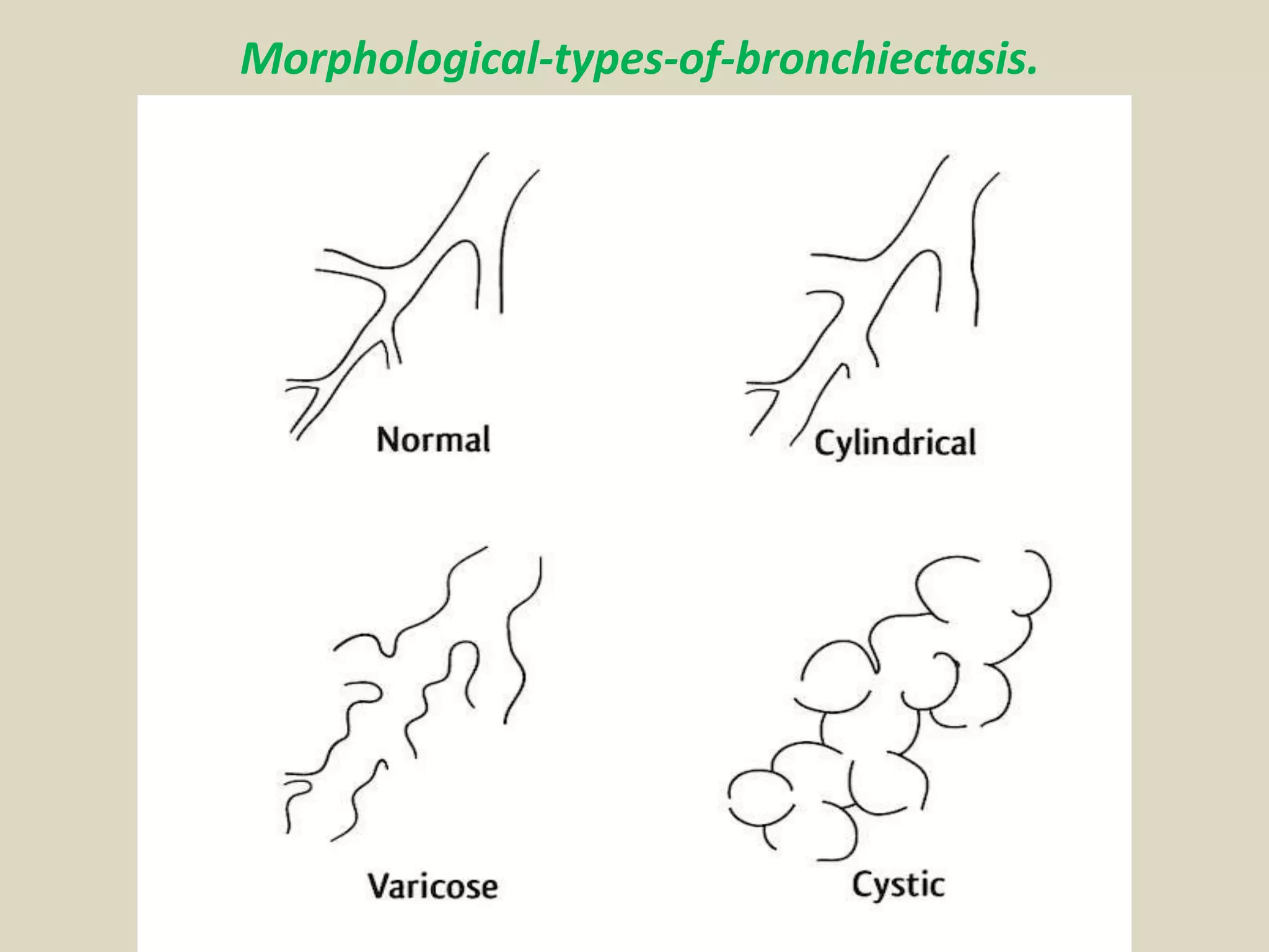 Presentation1.pptx, radiological imaging of bronchiectasis. | PPTX