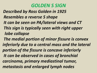Presentation1.pptx, radiological signs in thoracic radiology. | PPTX