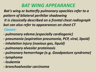 Presentation1.pptx, radiological signs in thoracic radiology. | PPT