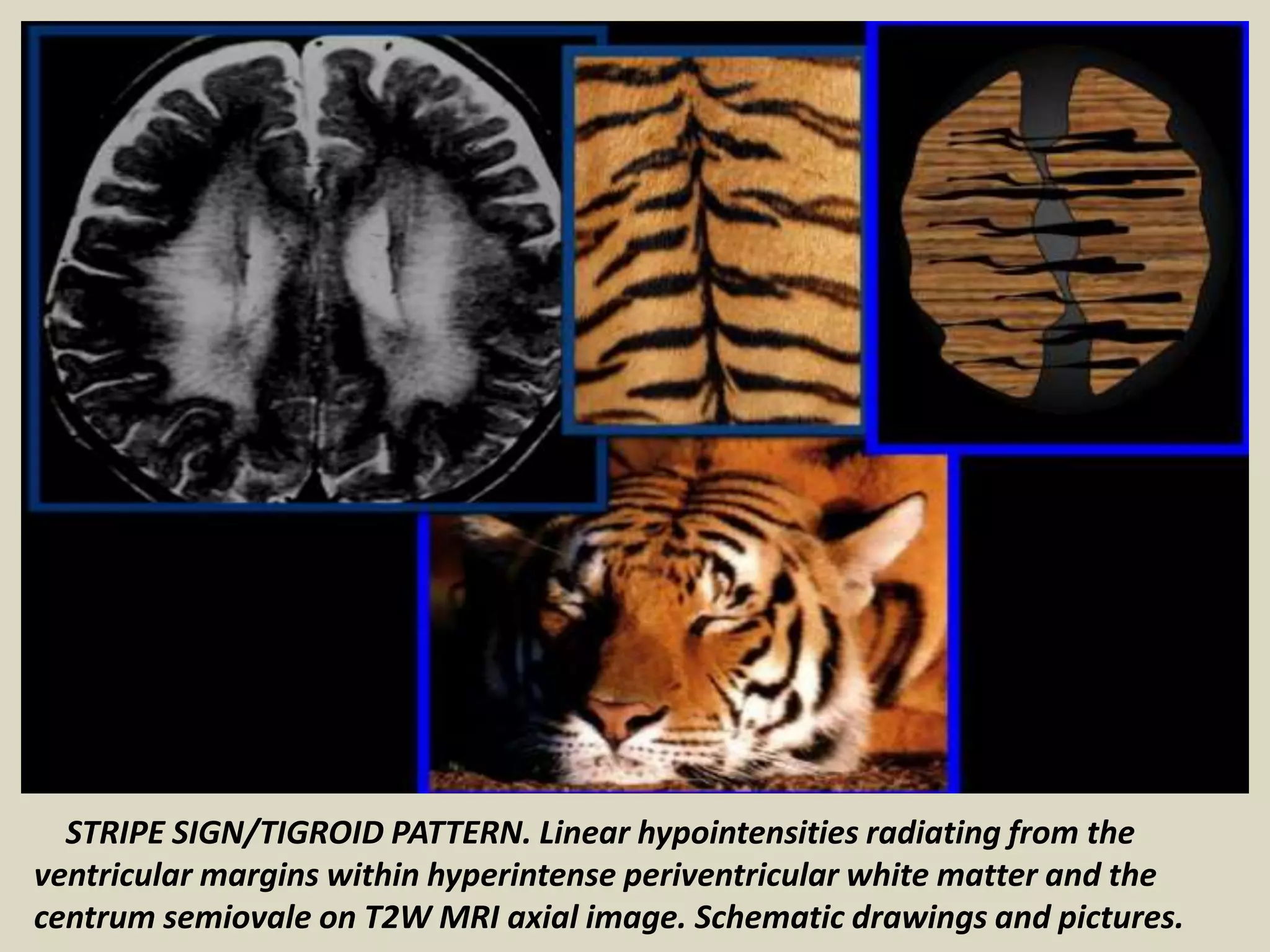 Presentation1.pptx, radiological classical signs and appearances in ...