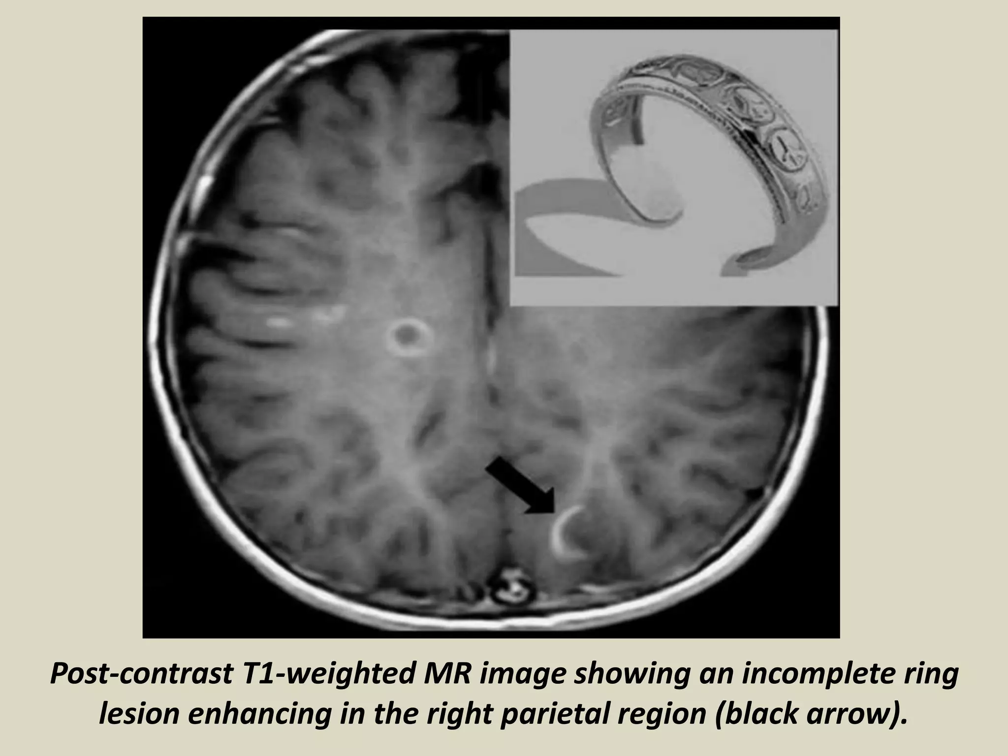 Presentation1.pptx, radiological classical signs and appearances in ...