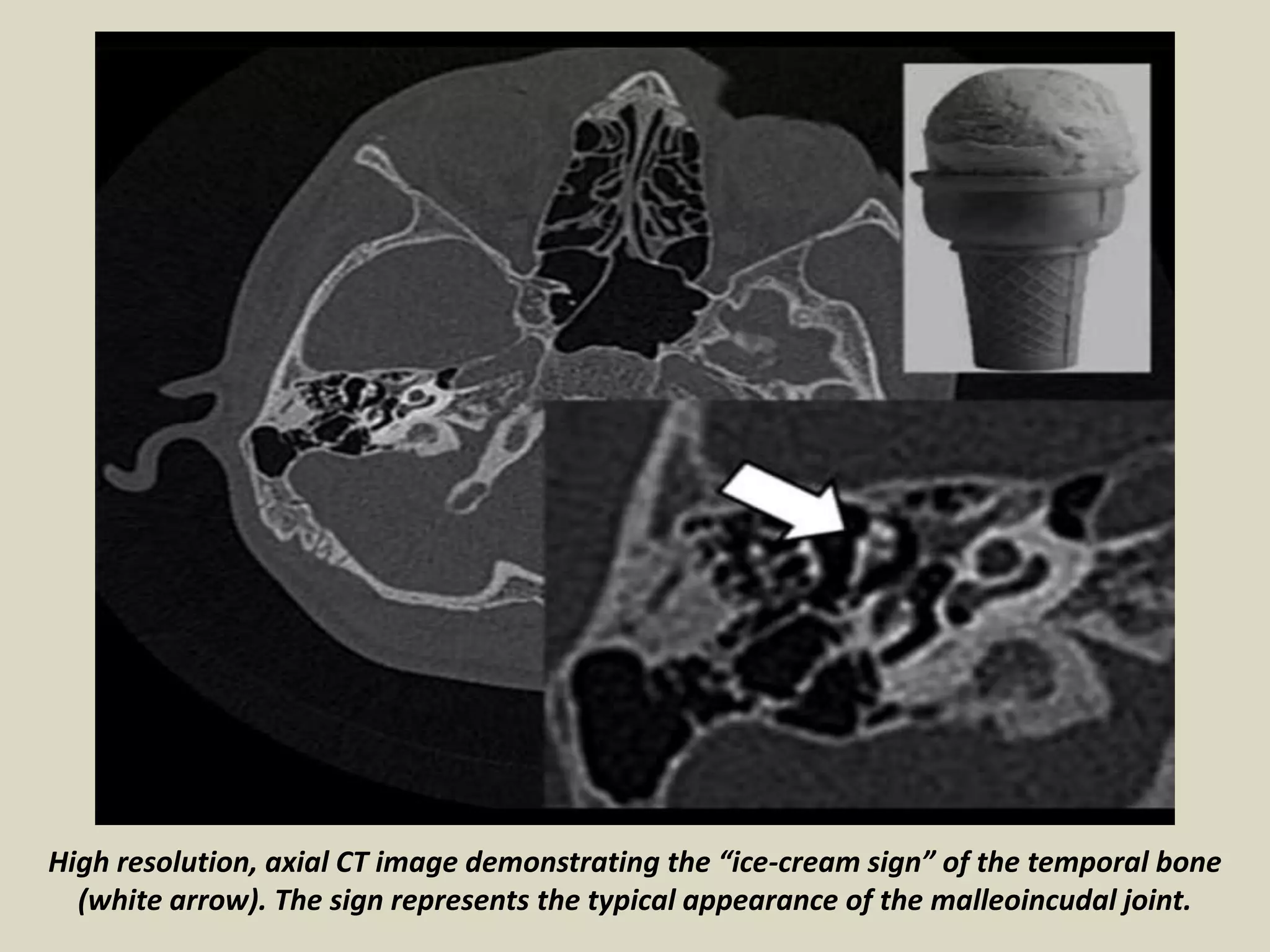 Presentation1.pptx, radiological classical signs and appearances in ...