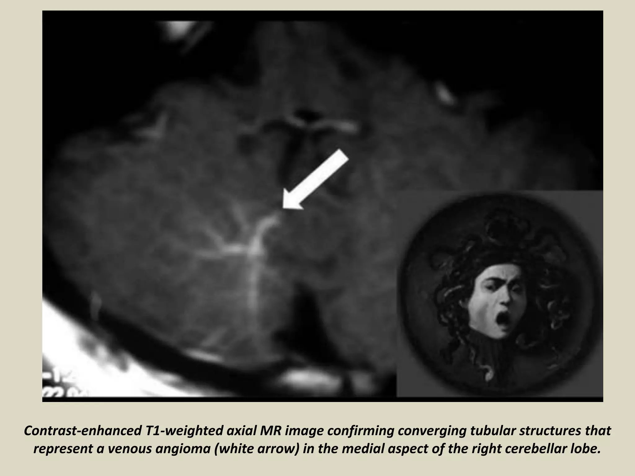 Presentation1.pptx, radiological classical signs and appearances in ...