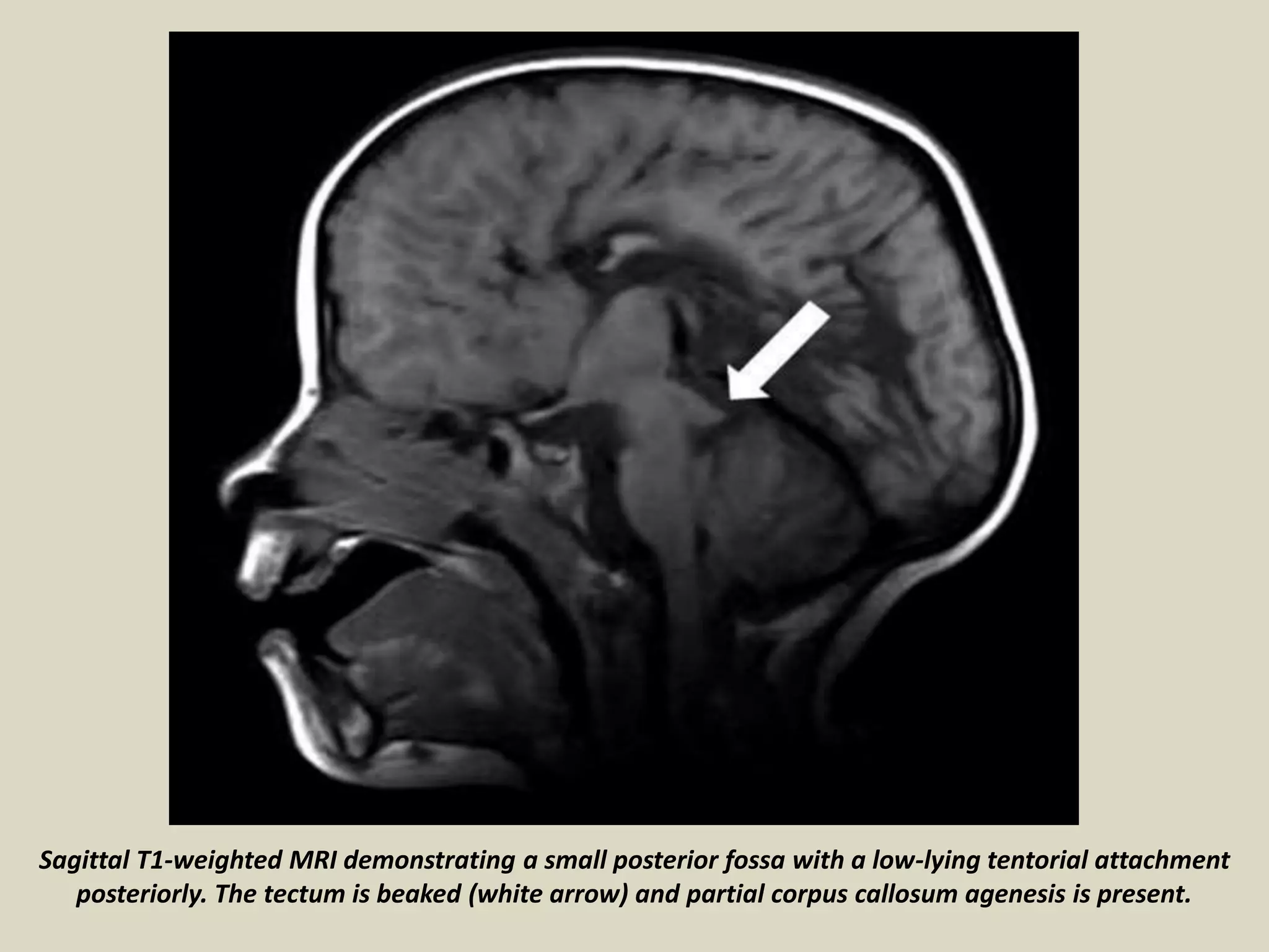 Presentation1.pptx, radiological classical signs and appearances in ...