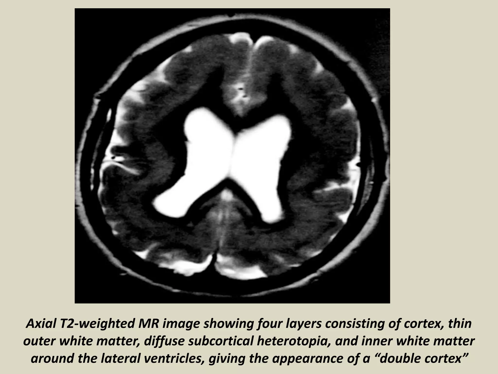 Presentation1.pptx, radiological classical signs and appearances in ...