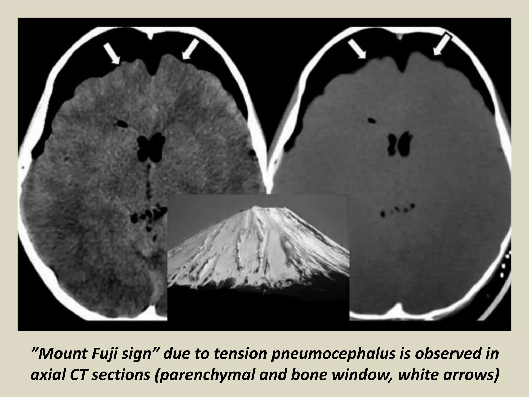 Presentation1.pptx, radiological classical signs and appearances in ...