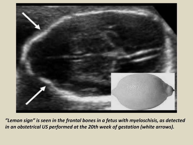 Presentation1.pptx, radiological classical signs and appearances in ...