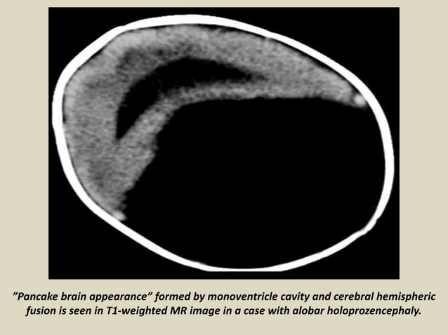 Presentation1.pptx, radiological classical signs and appearances in ...