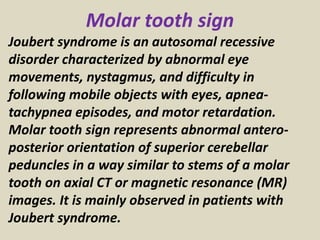 Presentation1.pptx, radiological classical signs and appearances in ...