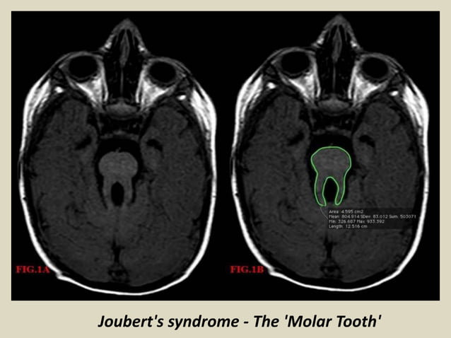 Presentation1.pptx, radiological classical signs and appearances in ...