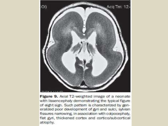 Presentation1.pptx, radiological classical signs and appearances in ...
