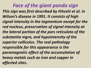 Presentation1.pptx, radiological classical signs and appearances in ...