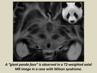 Presentation1.pptx, radiological classical signs and appearances in ...