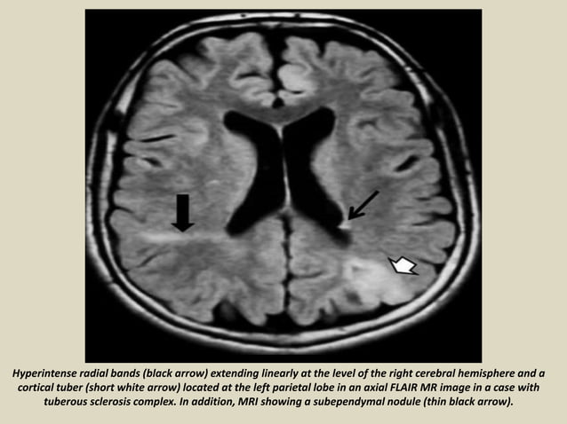 Presentation1.pptx, radiological classical signs and appearances in ...