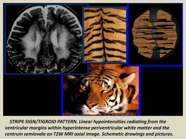 Presentation1.pptx, radiological classical signs and appearances in ...