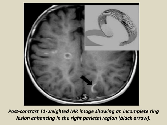 Presentation1.pptx, radiological classical signs and appearances in ...