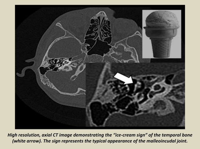 Presentation1.pptx, radiological classical signs and appearances in ...
