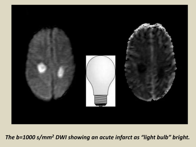 Presentation1.pptx, radiological classical signs and appearances in ...