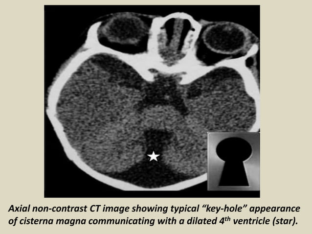 Presentation1.pptx, radiological classical signs and appearances in ...