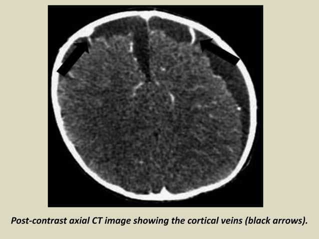 Presentation1.pptx, radiological classical signs and appearances in ...