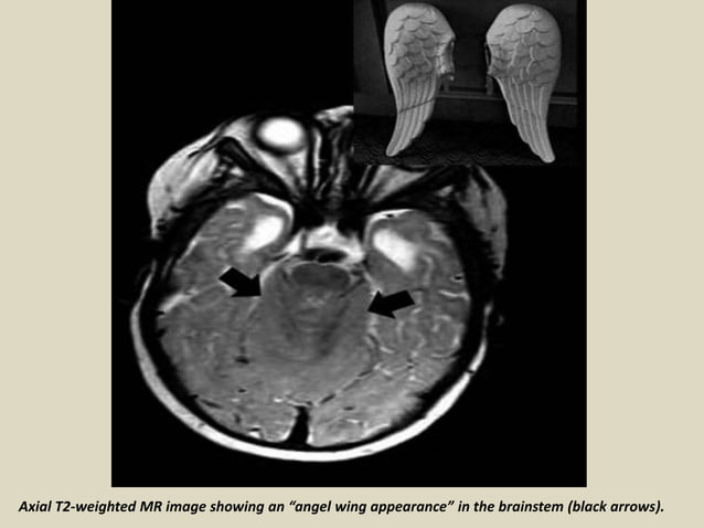 Presentation1.pptx, radiological classical signs and appearances in ...