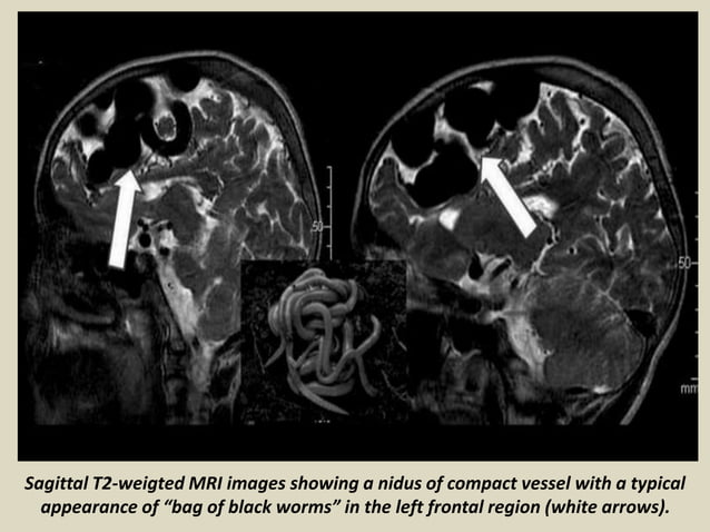 Presentation1.pptx, radiological classical signs and appearances in ...