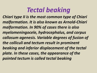 Presentation1.pptx, radiological classical signs and appearances in ...
