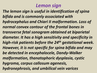 Presentation1.pptx, radiological classical signs and appearances in ...