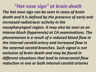Presentation1.pptx, radiological classical signs and appearances in ...