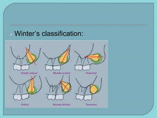 impacted maxillary 3rd molar & canine | PPTX
