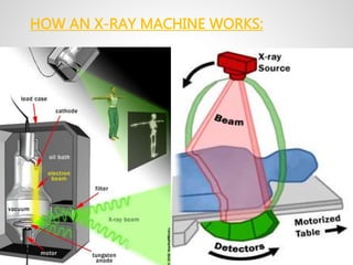 X Ray Machine Working