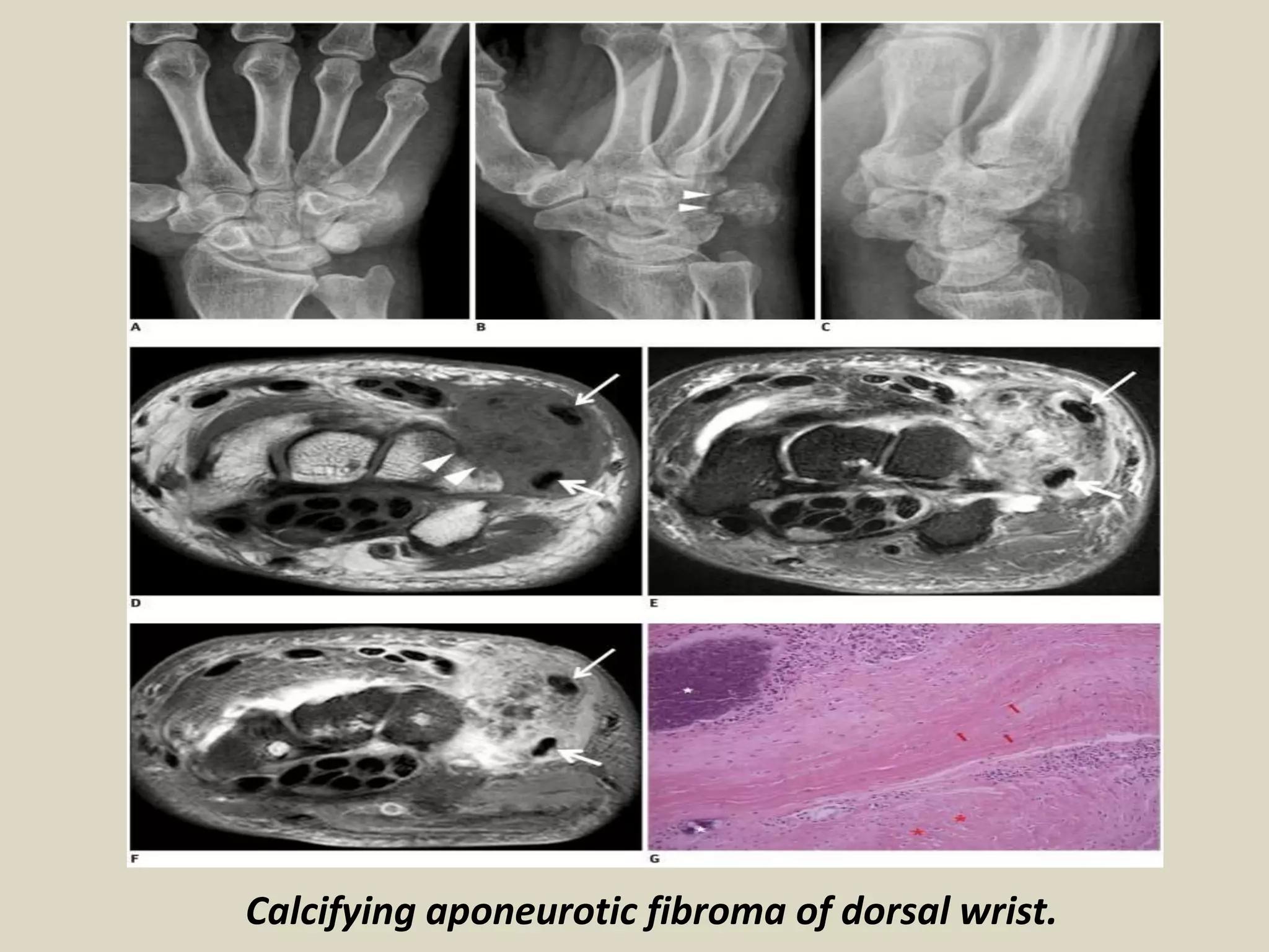 Presentation1.pptx, radiological imaging of soft tissue masses of the ...