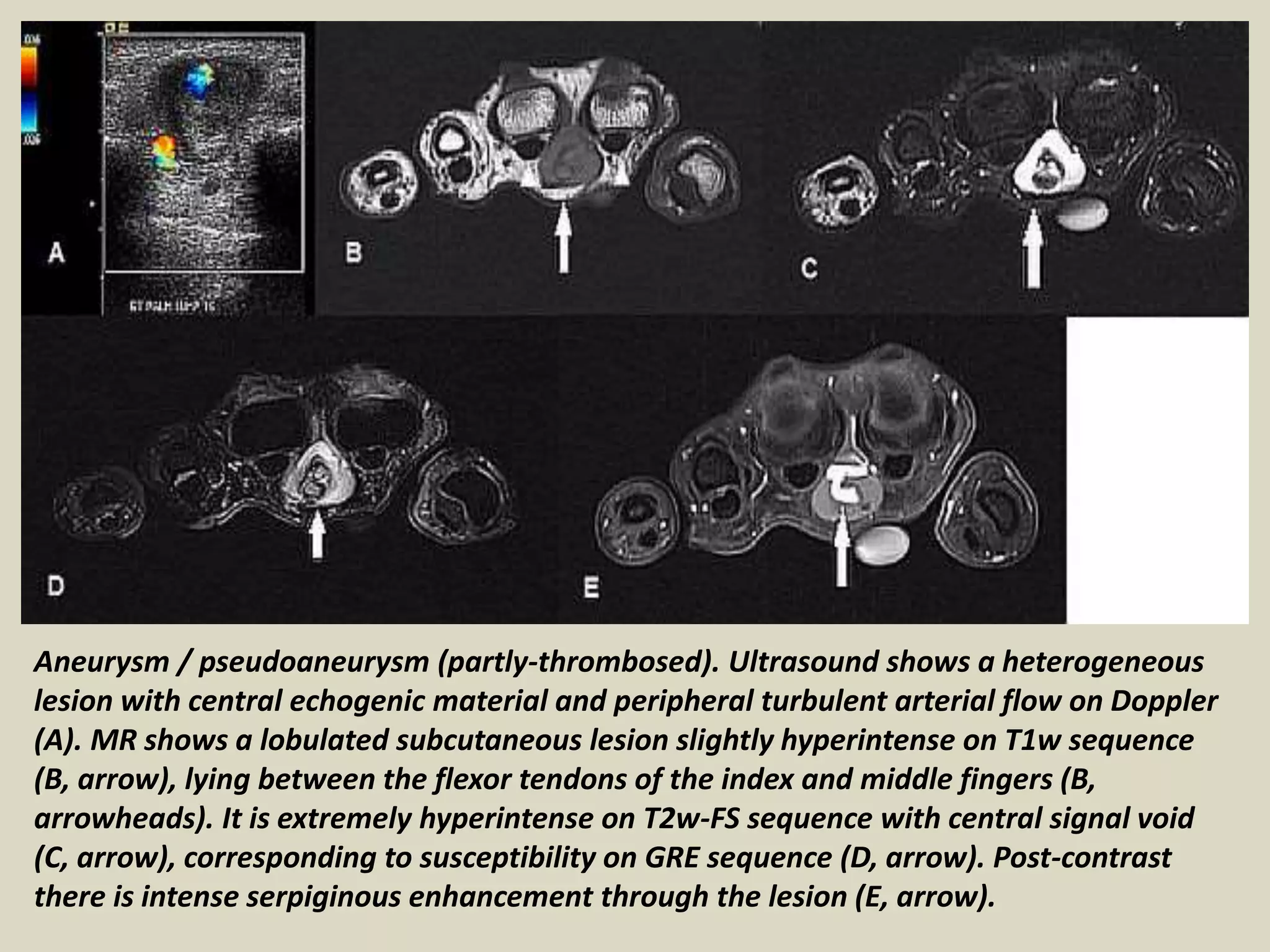 Presentation1.pptx, radiological imaging of soft tissue masses of the ...