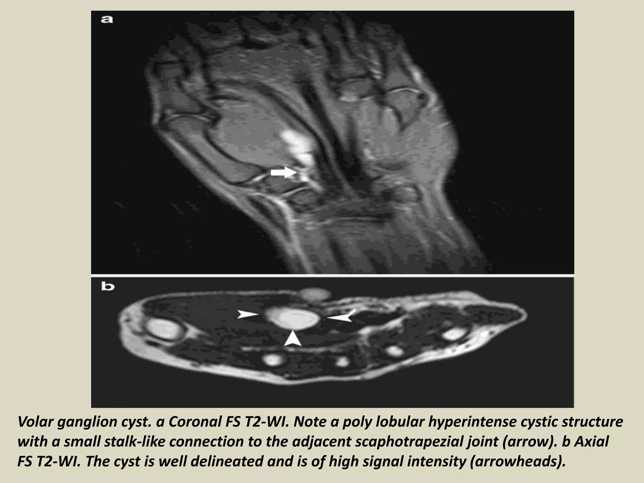 Presentation1.pptx, radiological imaging of soft tissue masses of the ...