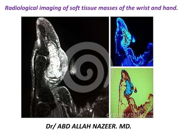 Presentation1.pptx, radiological imaging of soft tissue masses of the ...